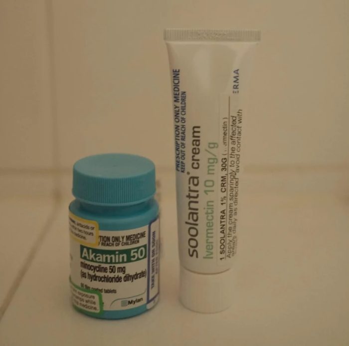 A Detailed Experience Treating Rosacea in Australia - Soolantra Cream Store