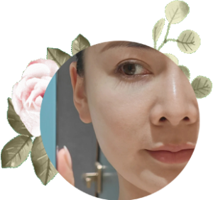Soolantra.net | Buy Soolantra (Ivermectin) 1% Cream Online